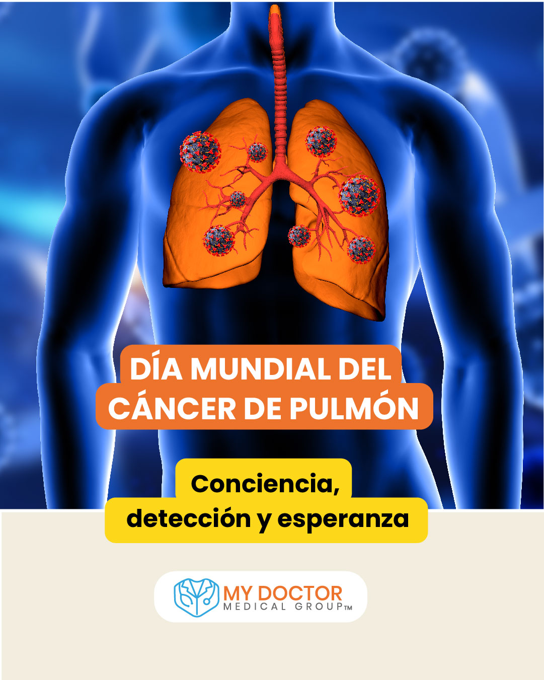 Cáncer de Pulmón 2025